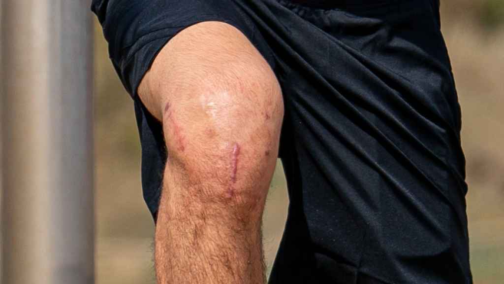 Gavi avanza a paso firme con su recuperación: la espectacular cicatriz ...