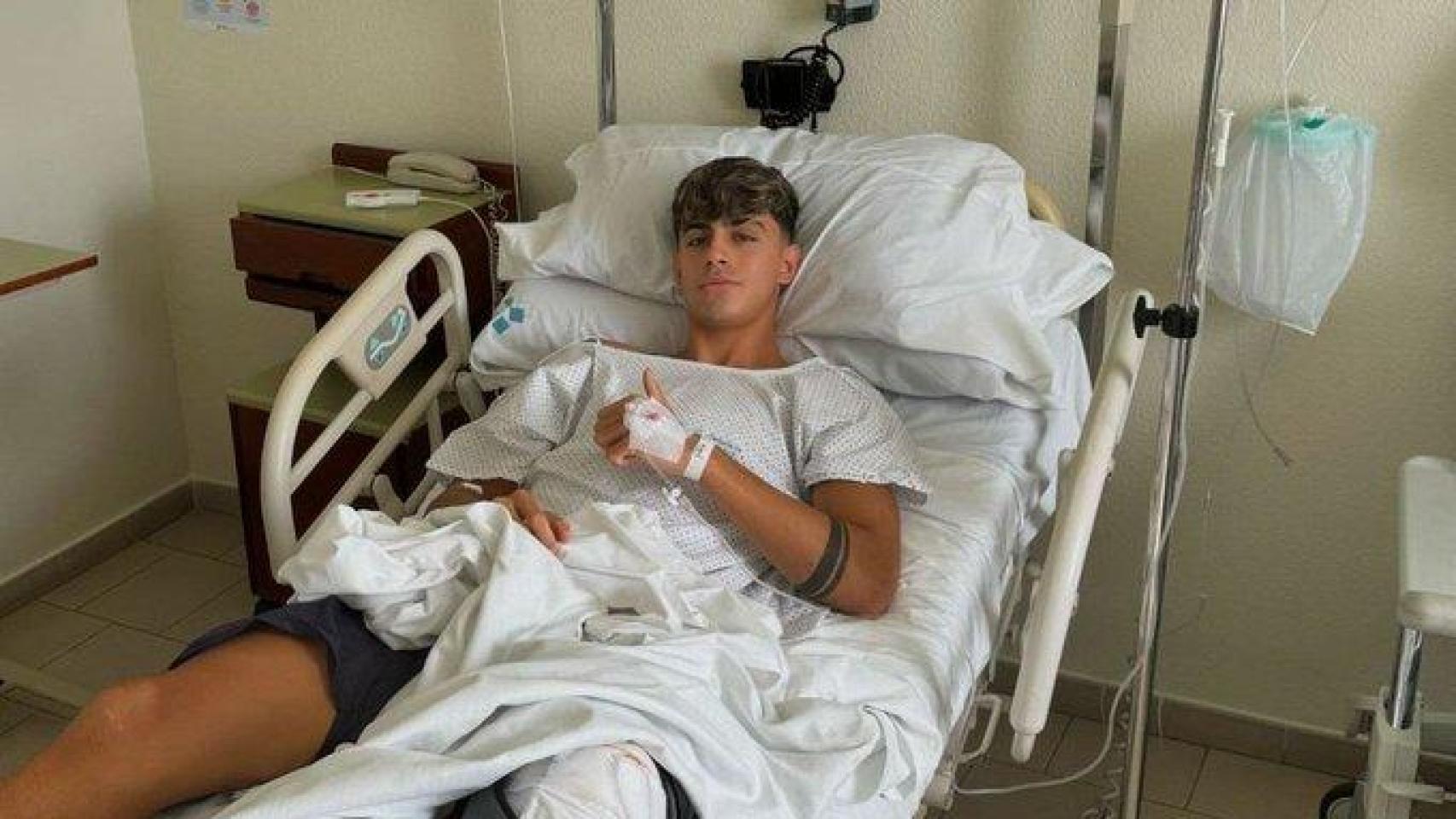 De Gavi a Marc Bernal: ¿la edad es un factor de riesgo para la rotura de ligamento cruzado?